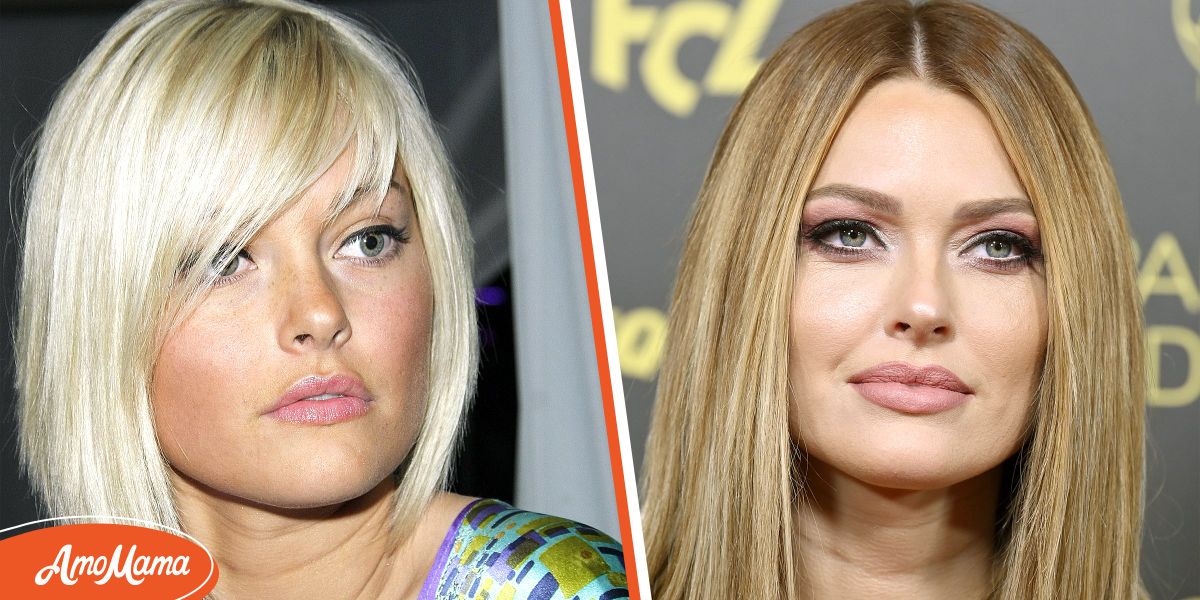 Caroline Receveur avant sa chirurgie avait des "seins vides" : dents ...