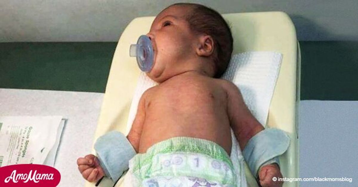 La photo d'un bébé attaché aux bras et aux jambes pour une circoncision ...