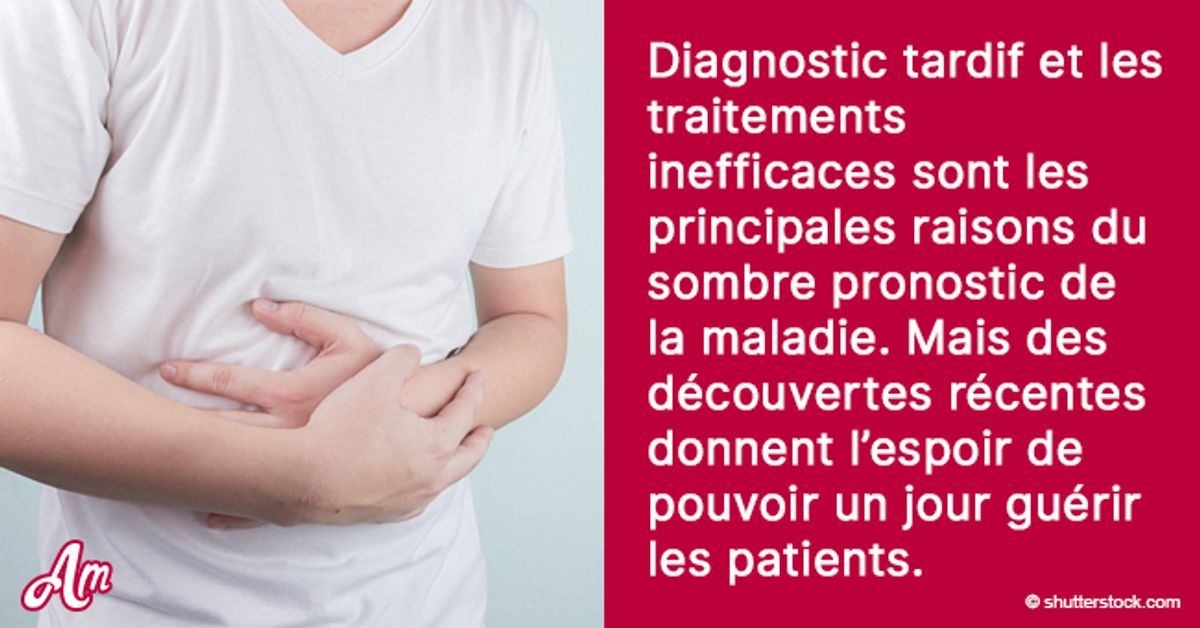 Comment bien démarrer le traitement d’un cancer du pancréas